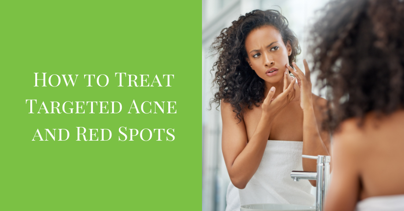 How to Treat Targeted Acne and Red Spots - Nutrition Goo Roo